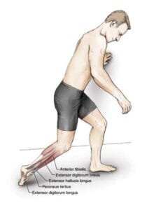 6 Exercises to Stretch Your Toes, Ankles, Soleus and Gastrocnemius ...