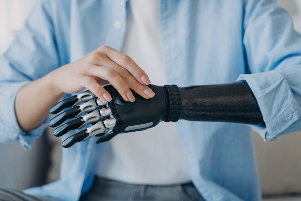 What is Phantom Limb Pain and How to Manage It? - The Health Science ...